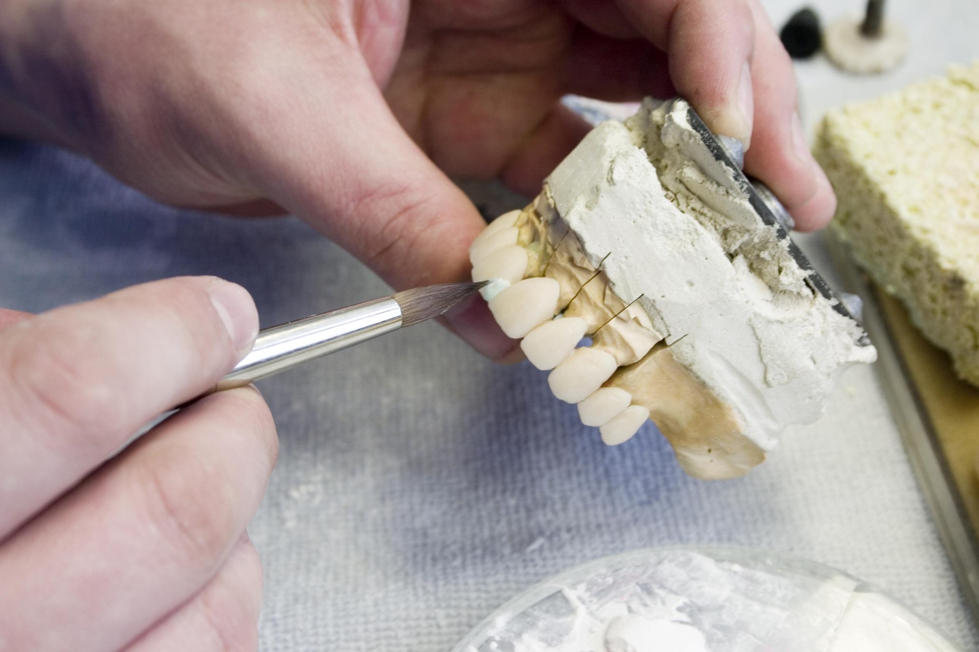 Dentures Dublin | Simon Dental Laboratories Ltd